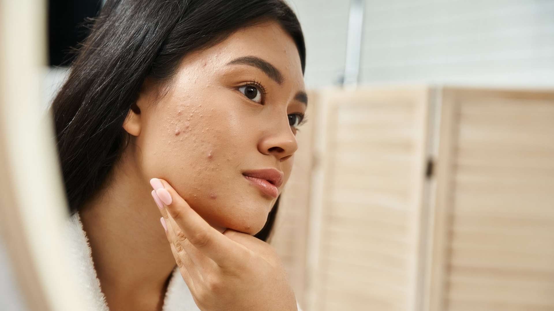 How to Treat Fungal Acne on Face: Expert Tips from Dermatologists ...